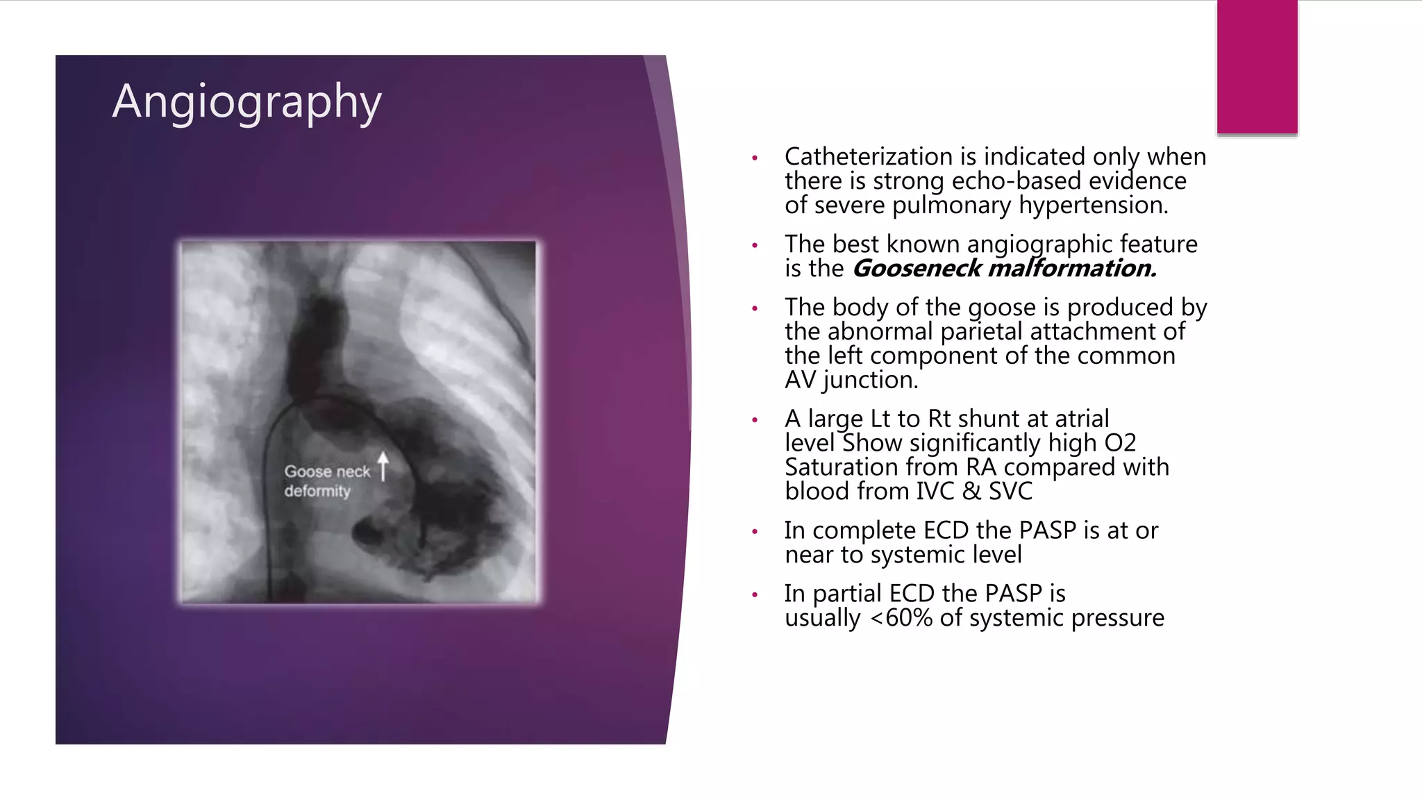 Endocardial Cushion Defect Avsd Ppt