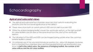 ecd-in congenital heart diseases PANDEY.pptx