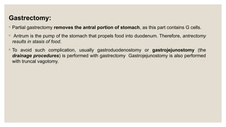 ECE - Peptic ulcer for first year MBBS lecture .pptx