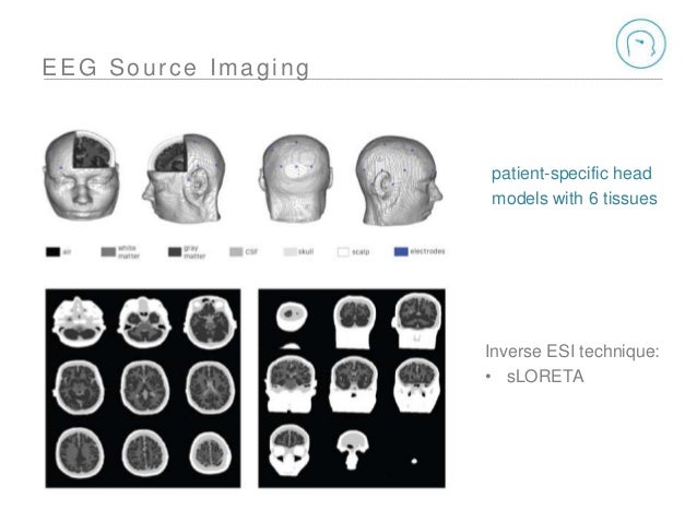 Epilog @ 12th European Congress on Epileptology, Prague