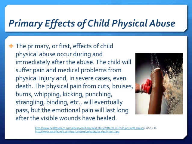 physical Child Abuse | PPTX | Injuries | Diseases and Conditions