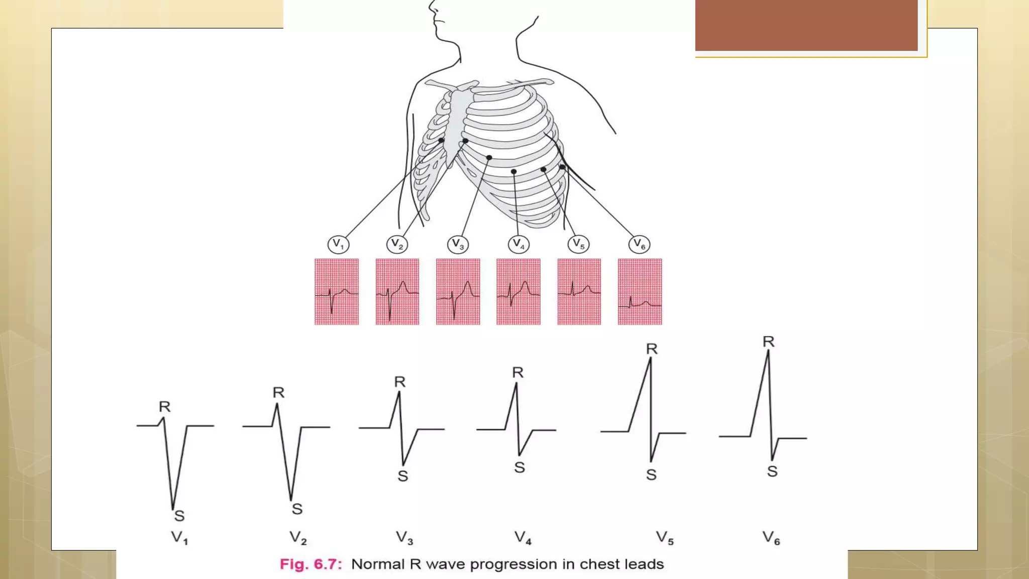 ECG - 1 Toward the Basics | PPTX