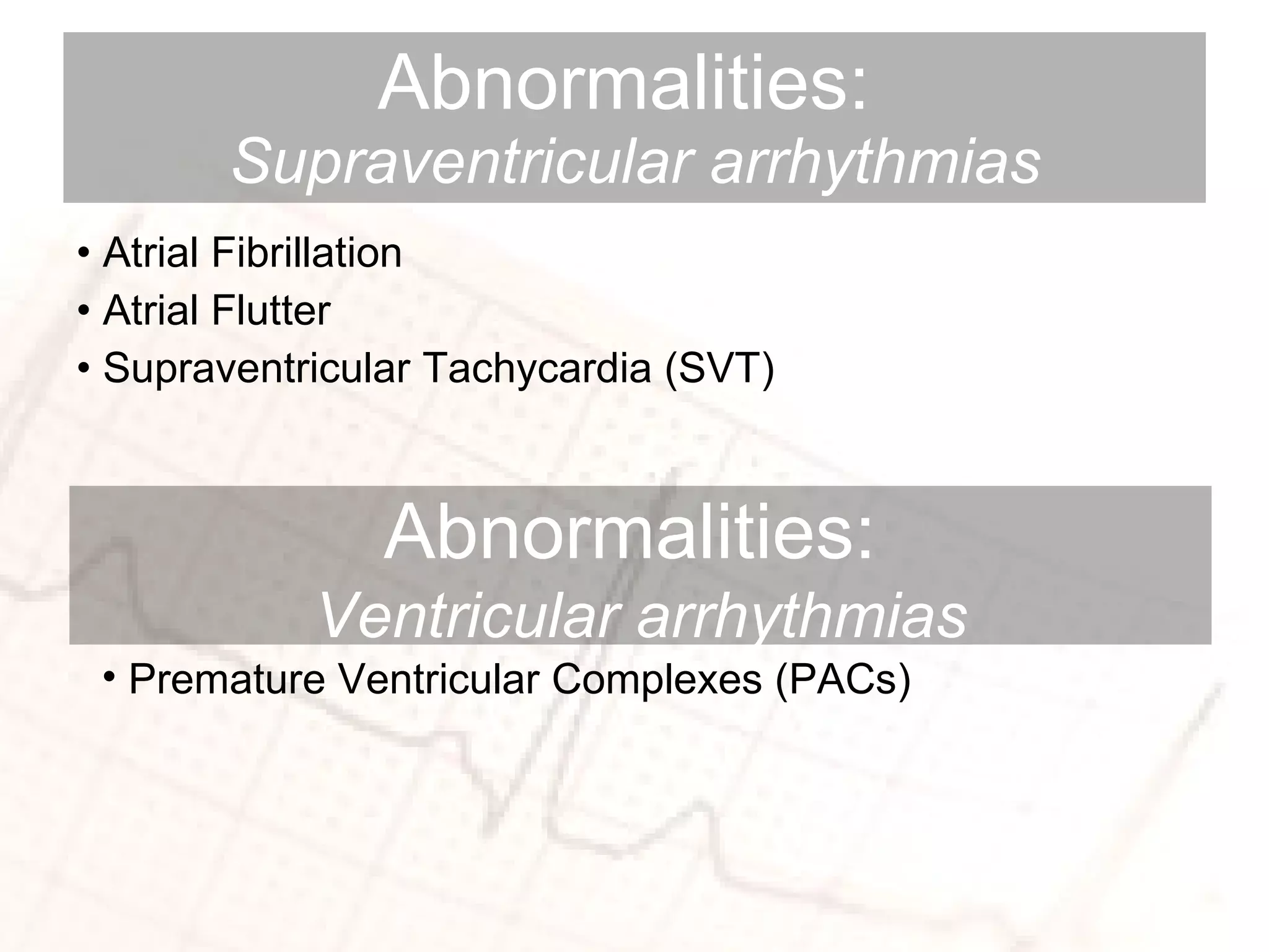 ECG interpretation: the basics | PPT