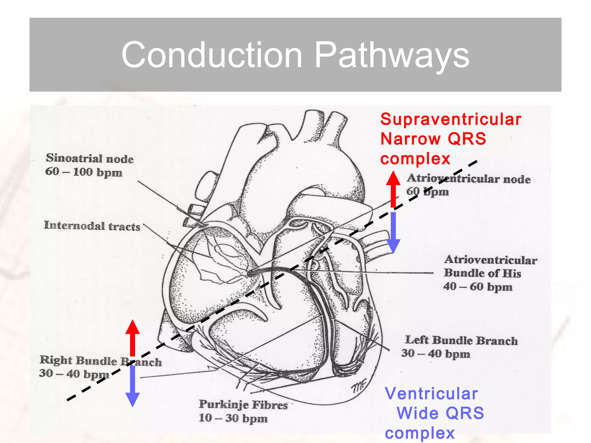 ECG interpretation: the basics | PPT