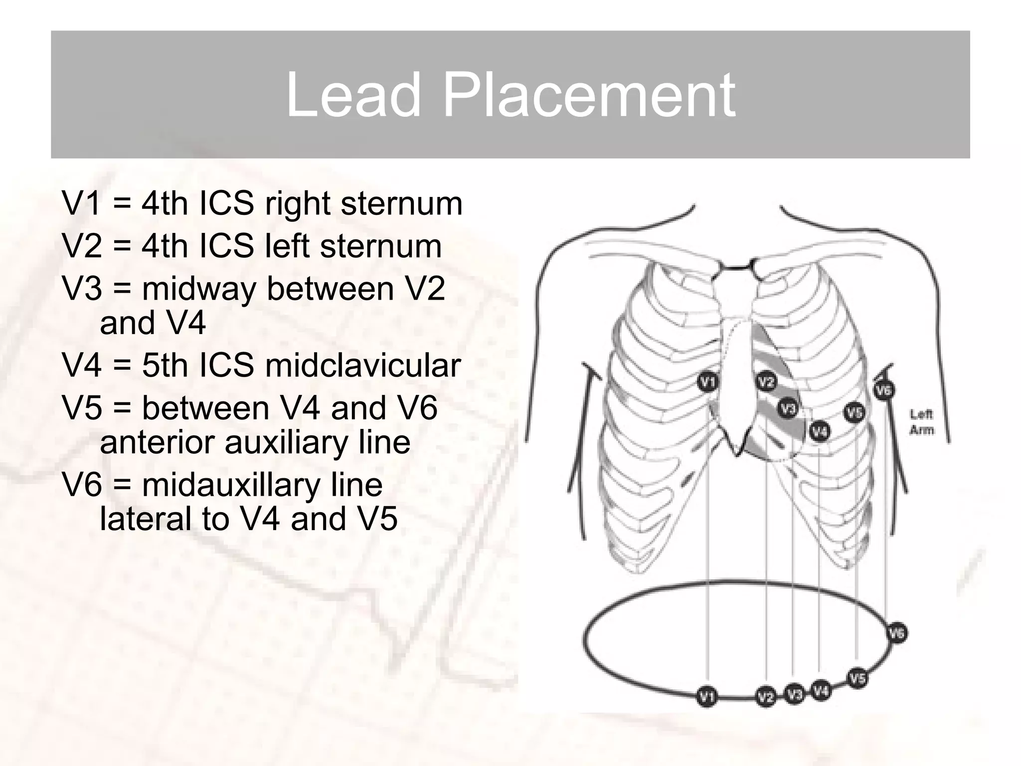 ECG interpretation: the basics | PPT