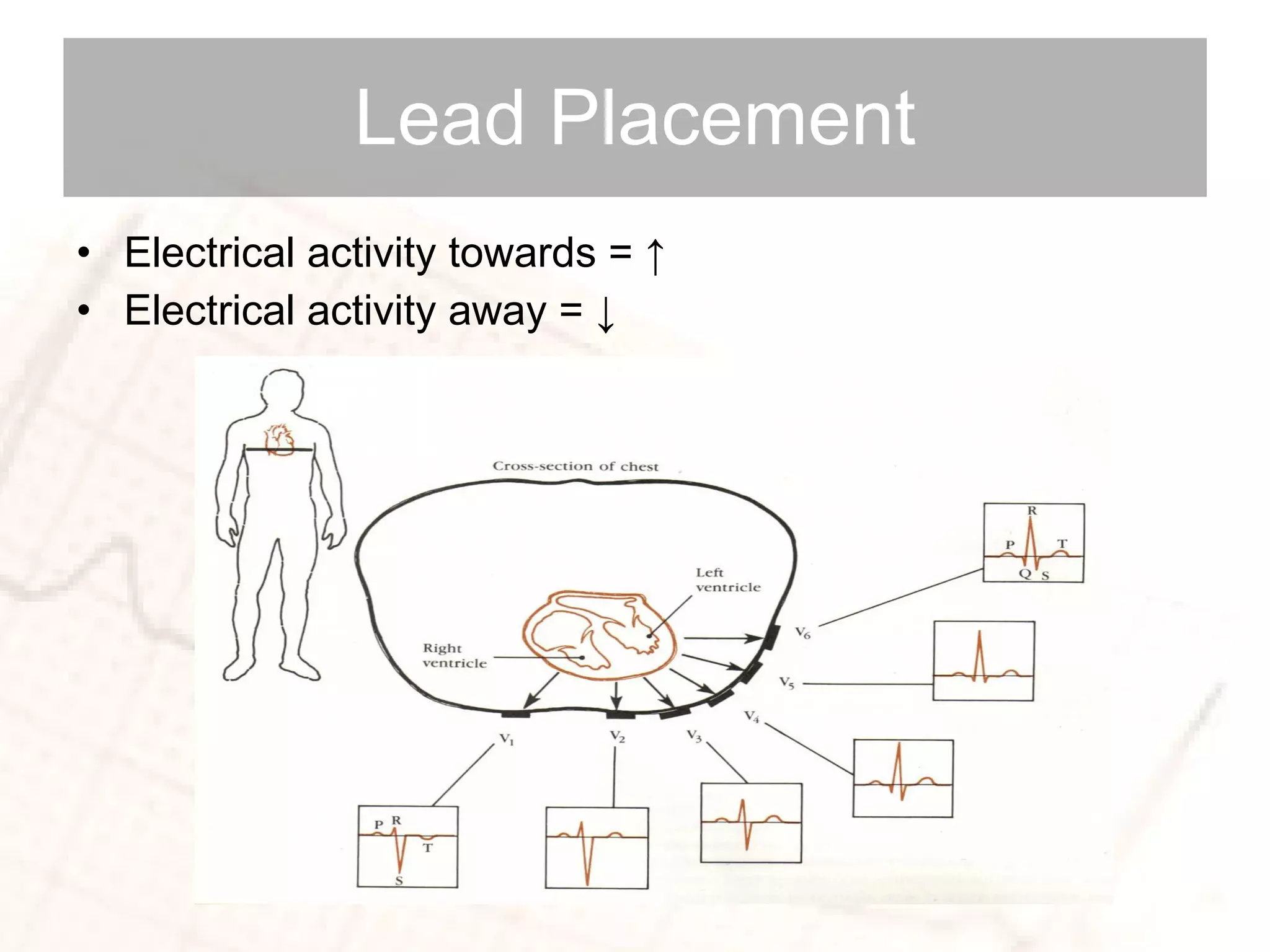 ECG interpretation: the basics | PPT