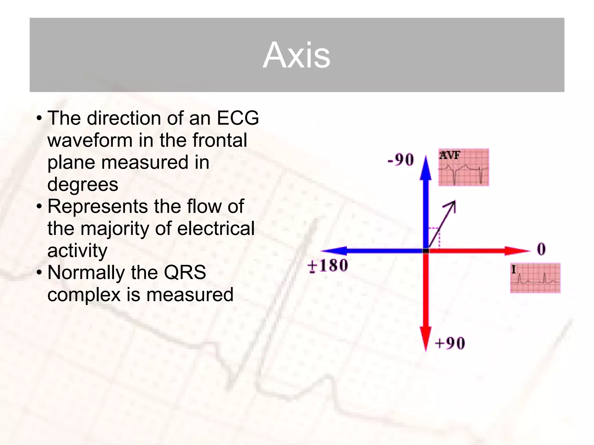 ECG interpretation: the basics | PPT