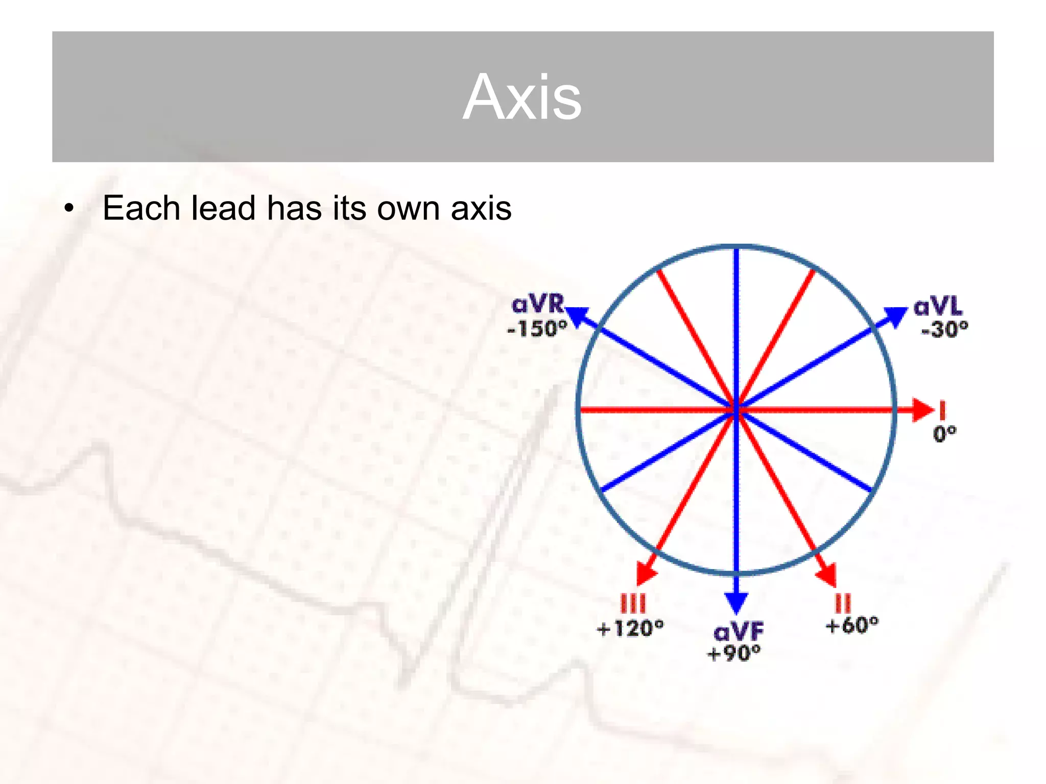 ECG interpretation: the basics | PPT