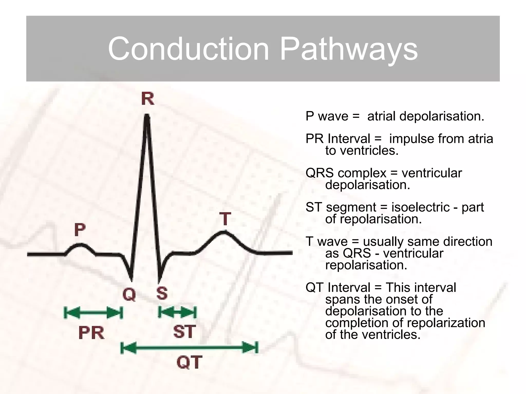 ECG interpretation: the basics | PPT