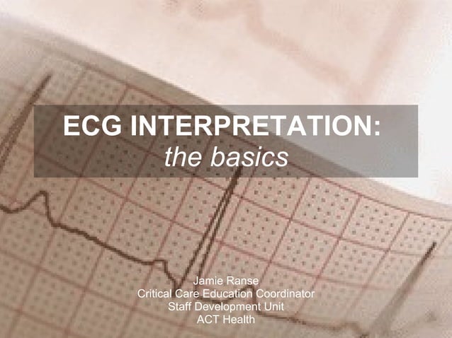 ECG interpretation: the basics | PPT