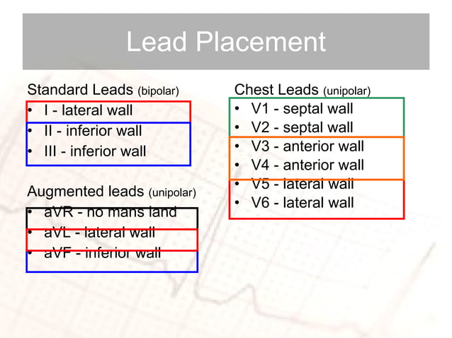 ECG interpretation: the basics | PPT