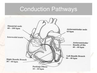 ECG interpretation: the basics | PPT