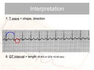 ECG interpretation: the basics | PPT