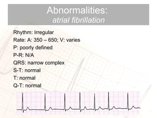 Ecg Reading Normal And Abnormal