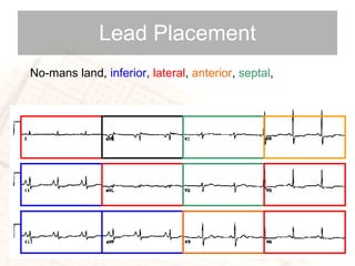 Lead Ekg Basics