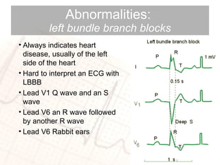 Abnormal Ecg Interpretation
