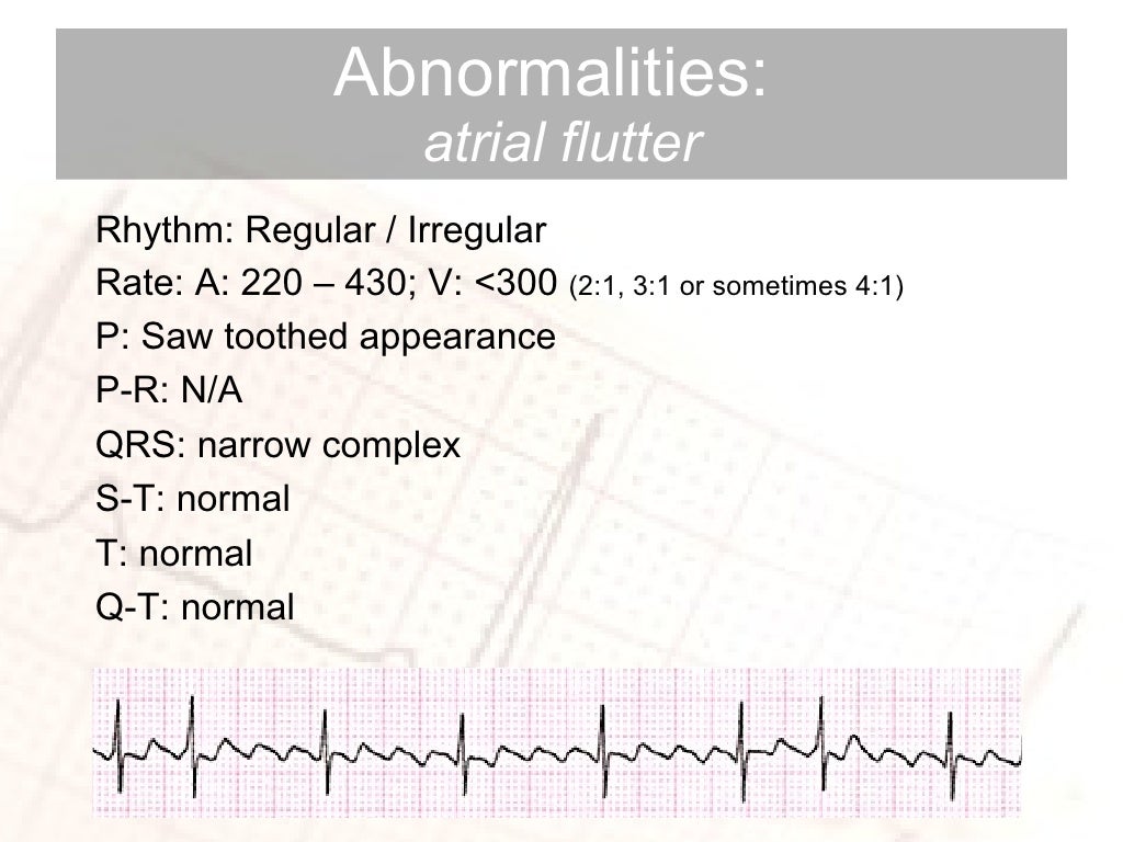ECG interpretation: the basics