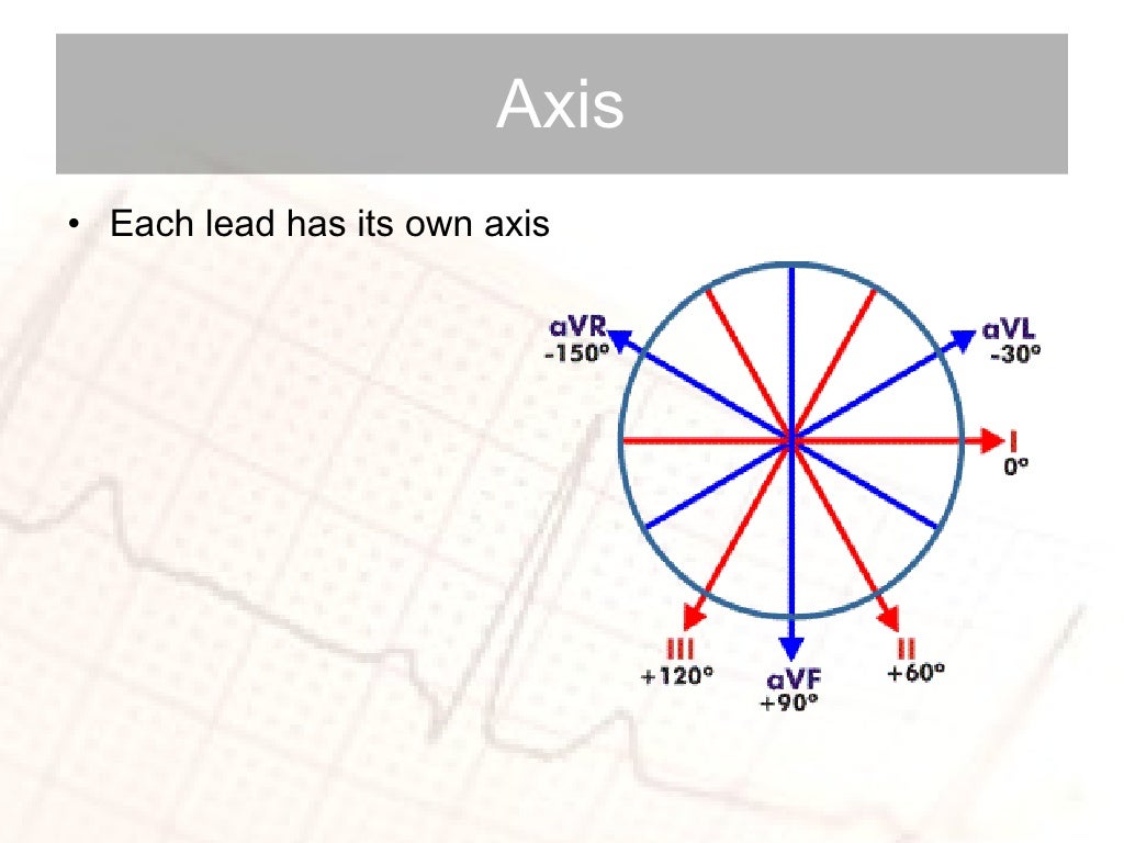 ECG interpretation: the basics