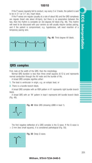 Ecg | PDF
