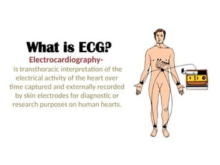 ecg-111029102429-phpapp0187878787878.ppt