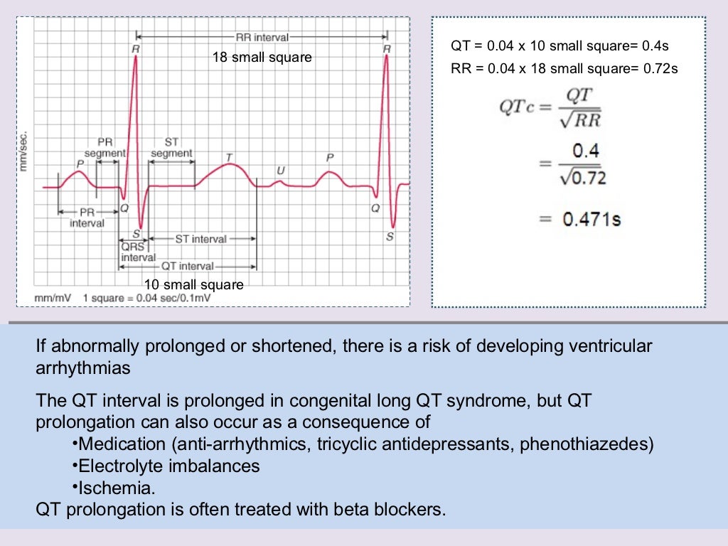 ECG