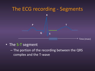 Ecg | PPTX | Heart and Cardiovascular Diseases | Diseases and Conditions