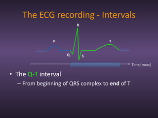 Ecg | PPTX