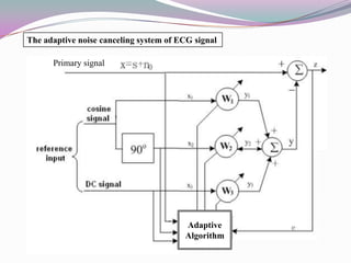 ECG Noise cancelling | PPTX
