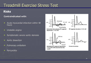 Ecg | PPT