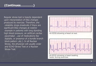Ecg | PPT