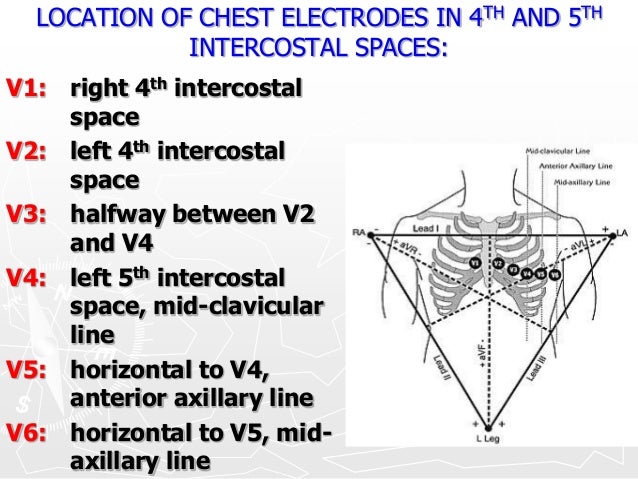 Ecg