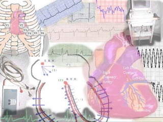 ECG | PPS