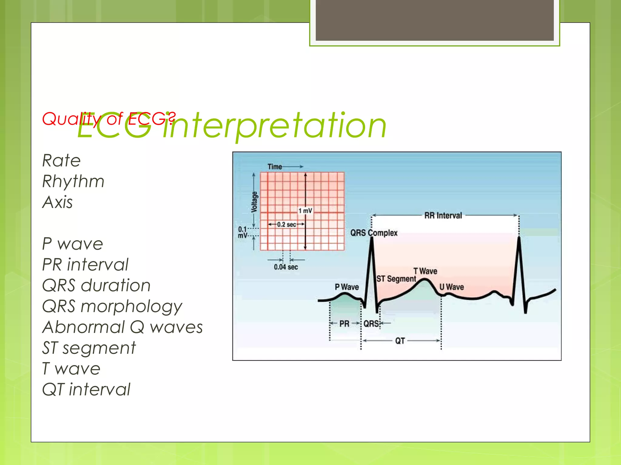 Ecg | PPT