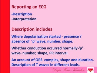 ECG | PPT