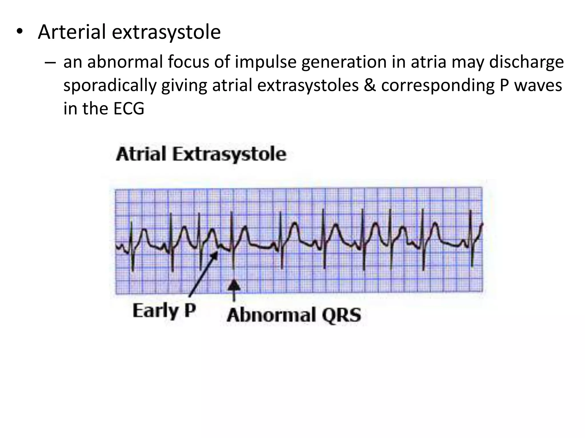 Electrocardiography | PPTX