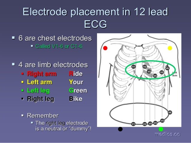 ECG