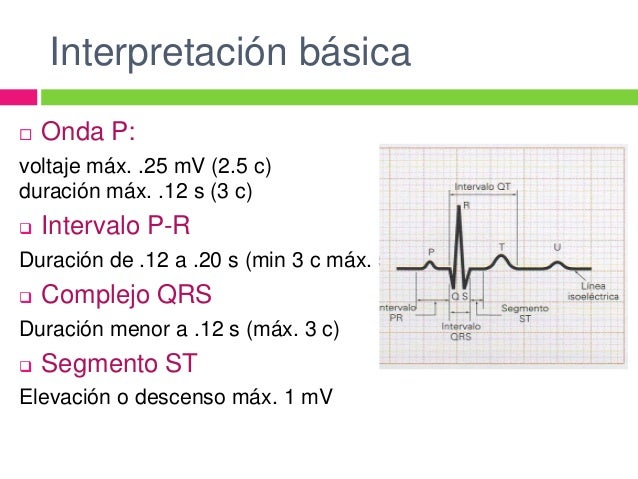 Electrocardiograma