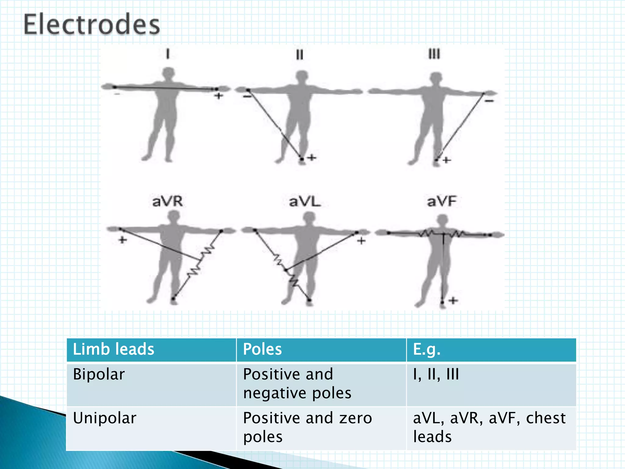 ECG: Indication and Interpretation | PPTX