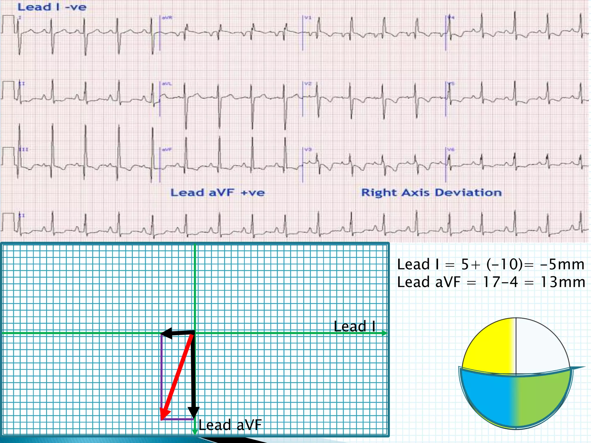 ECG: Indication and Interpretation | PPTX