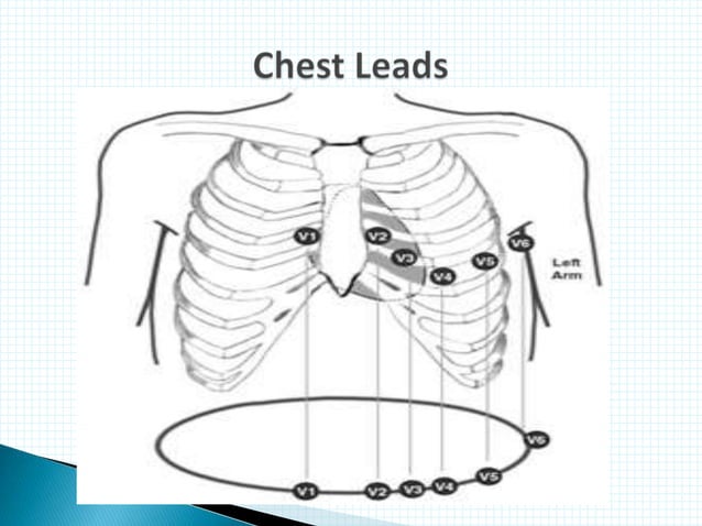 ECG: Indication and Interpretation | PPTX