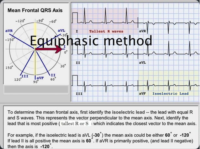 ECG: Indication and Interpretation | PPTX