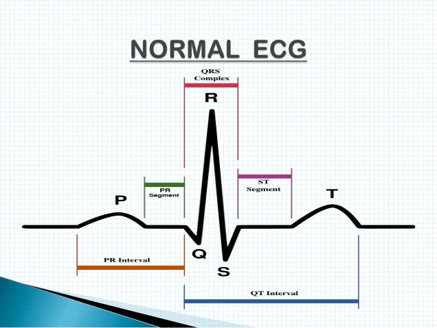 ECG: Indication and Interpretation