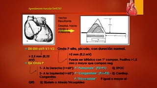 Ecg Patologicos | PPTX