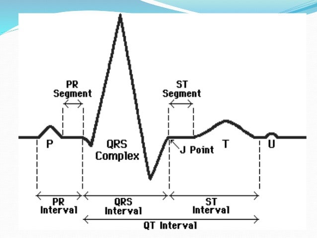 Ecg basics