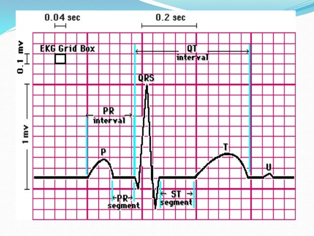 Ecg basics