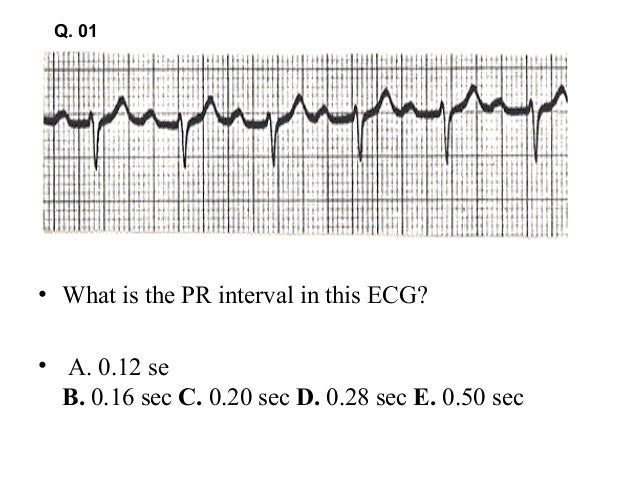 Ecg