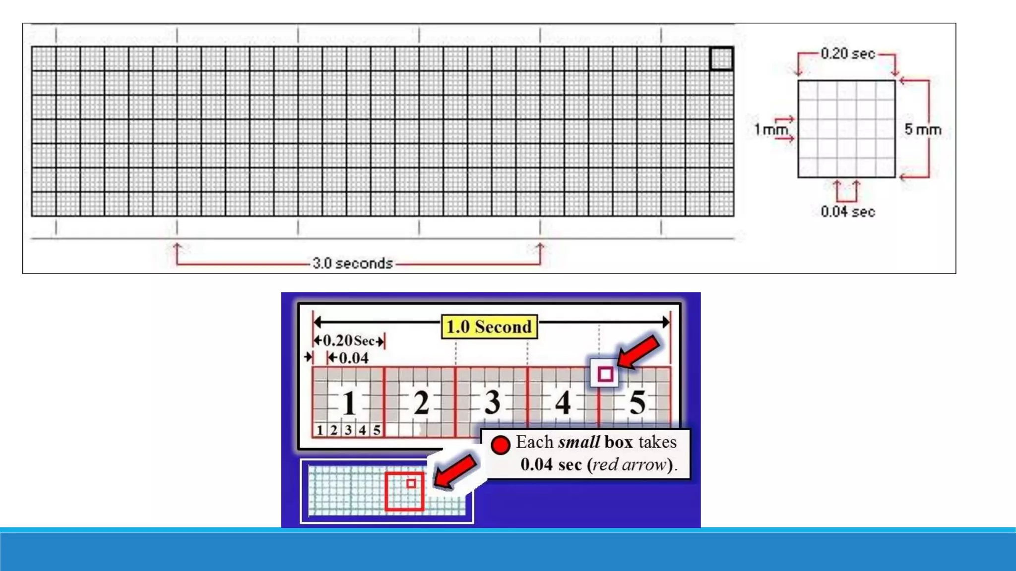 Basic ECG notes | PPTX
