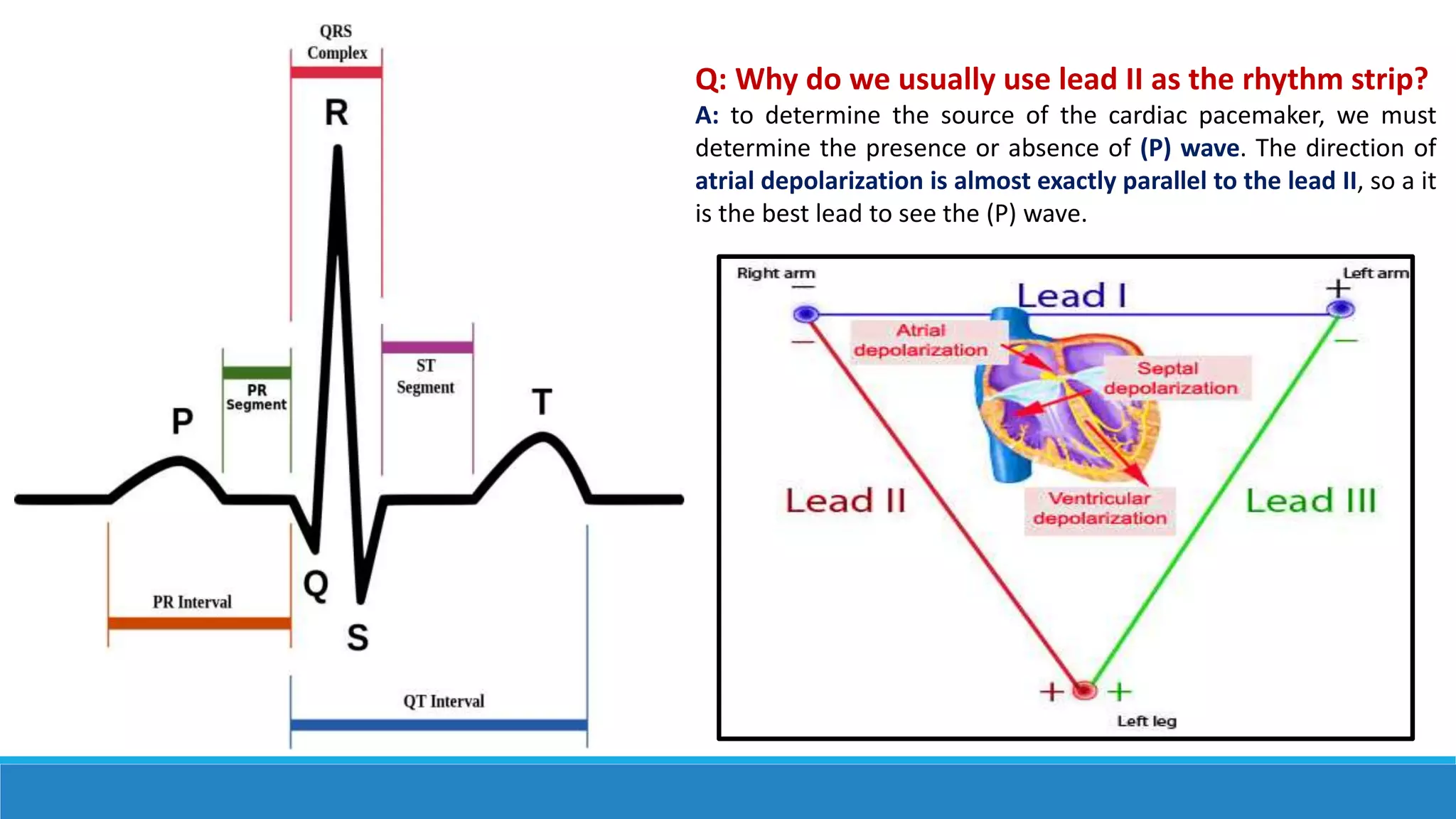 Basic ECG notes | PPTX