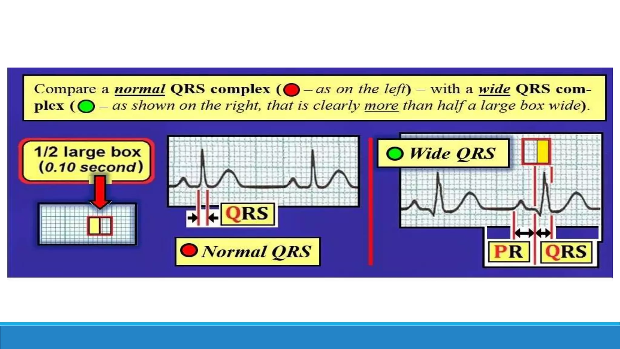 Basic ECG notes | PPTX