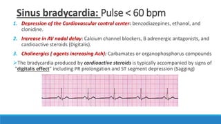 Basic ECG notes | PPTX